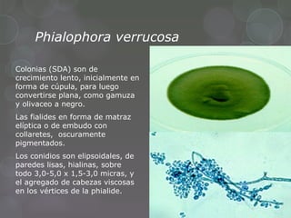 Phialophora Verrucosa