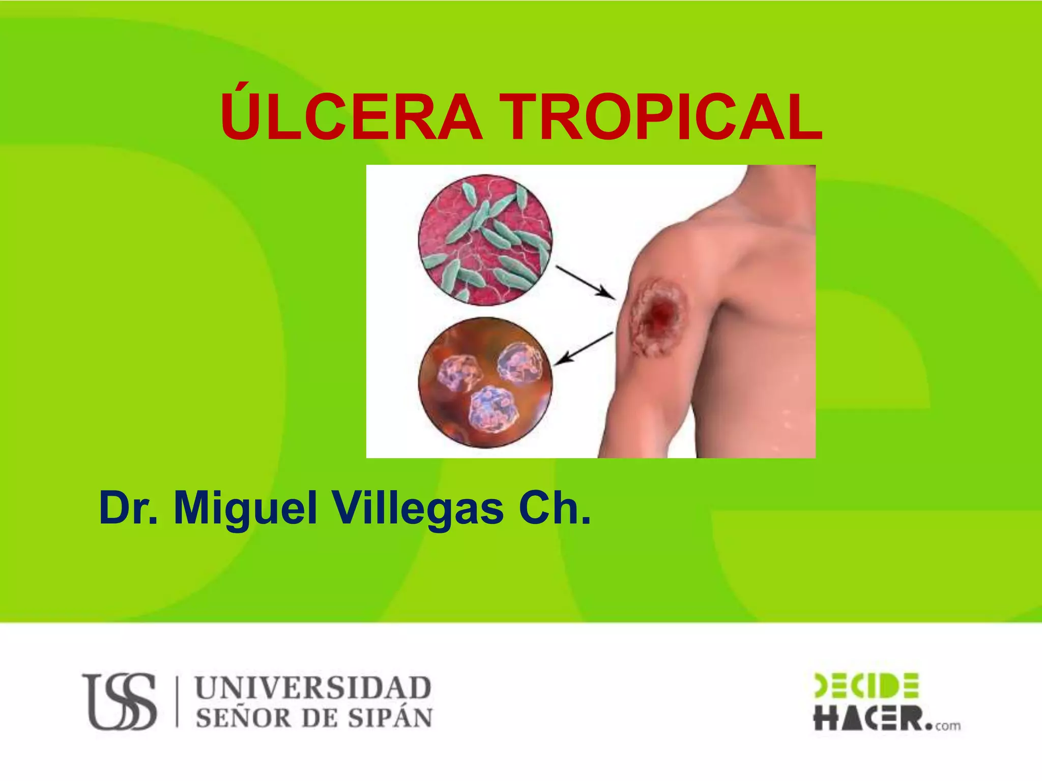 Clase 11. Úlcera Tropical.pptx