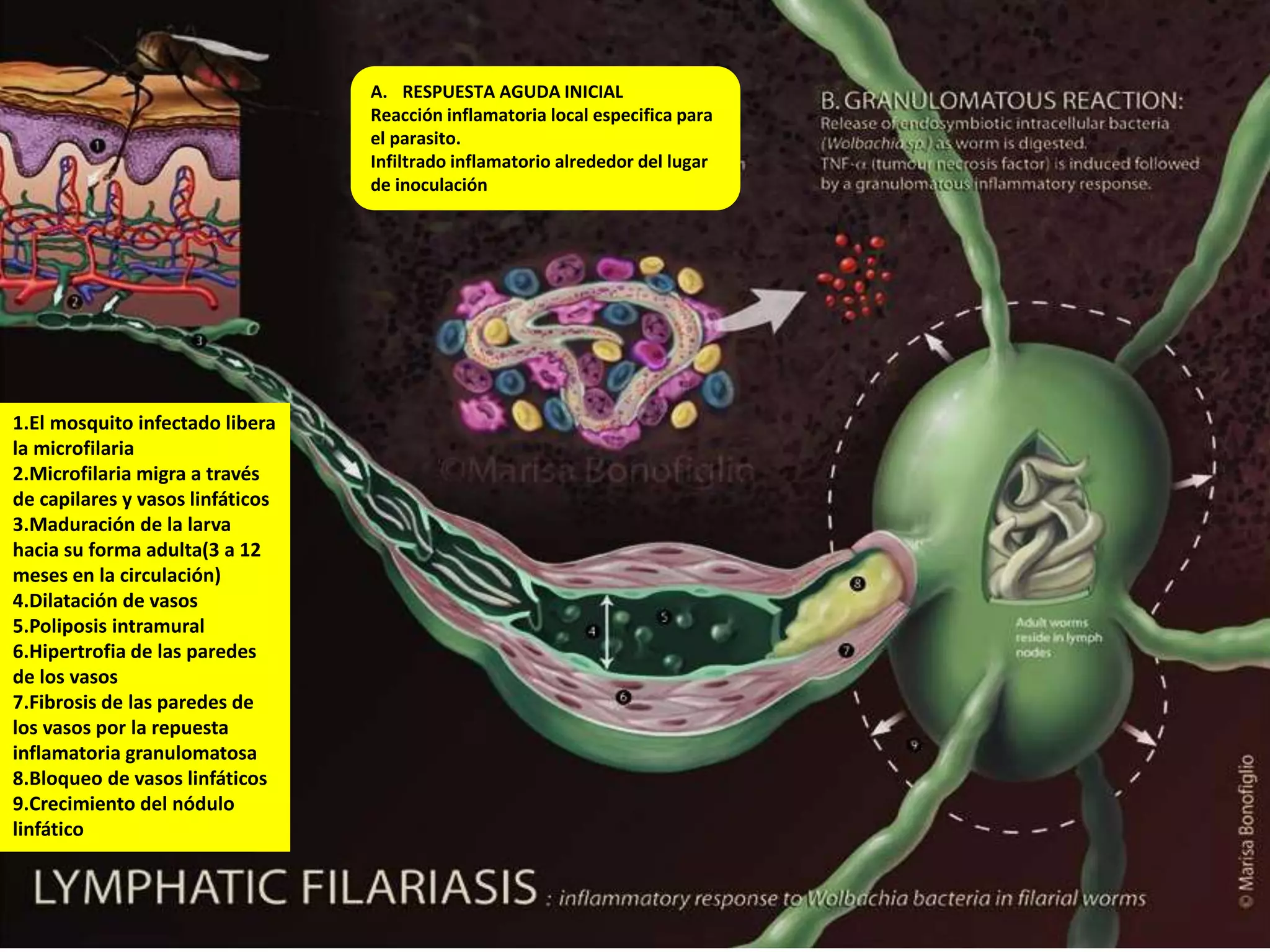 Clase 11 filariasis linfatica | PPTX