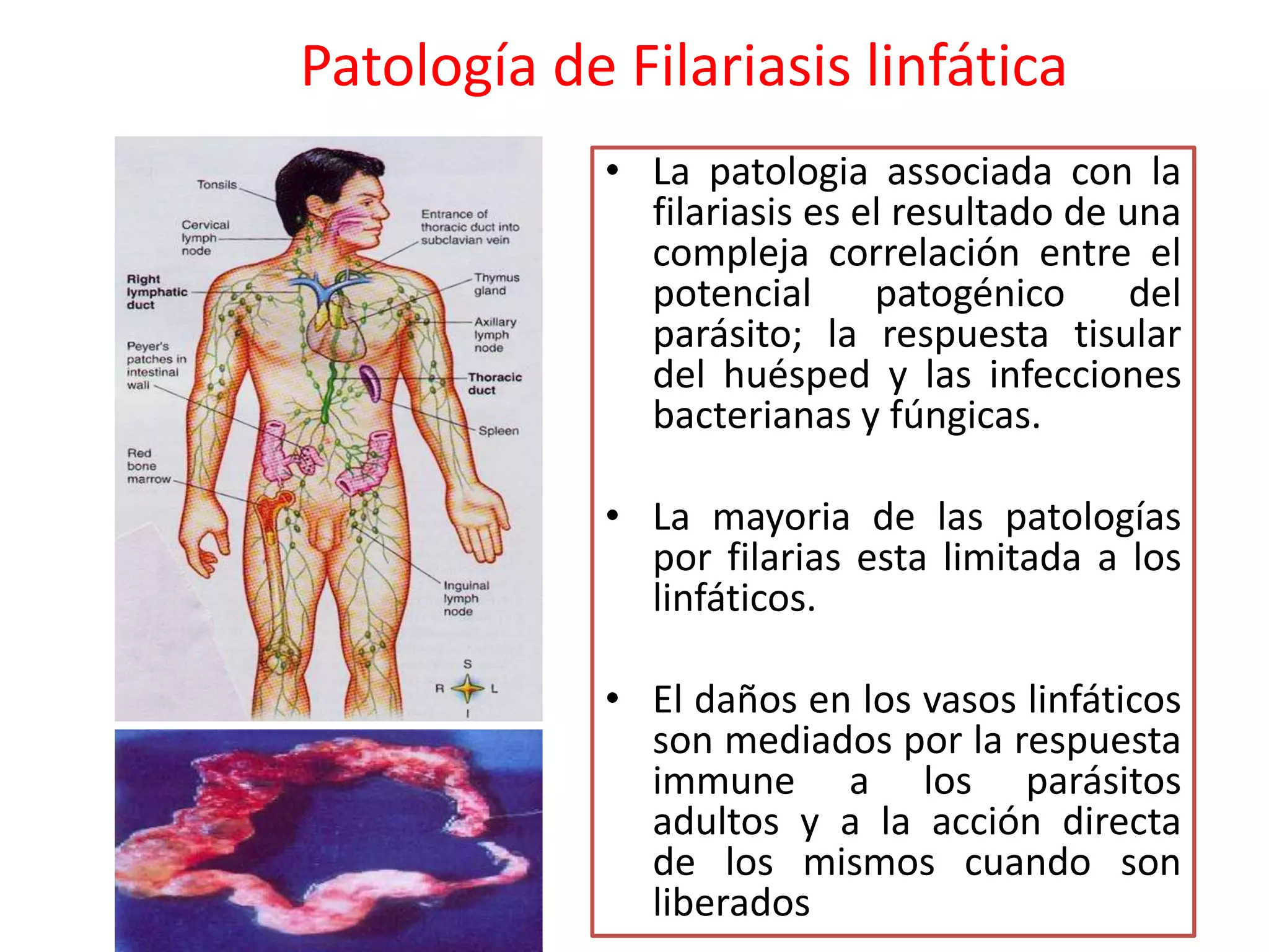 Clase 11 filariasis linfatica | PPTX
