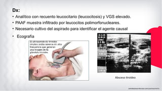 CLASE 12 TIROIDITIS MEDICINA INTERNA pptx | PPTX