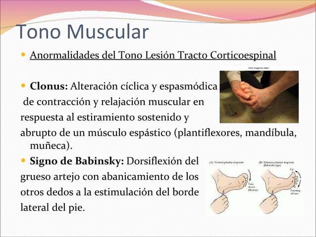 Clase 12 Tono Muscular Normal y sus alteraciones