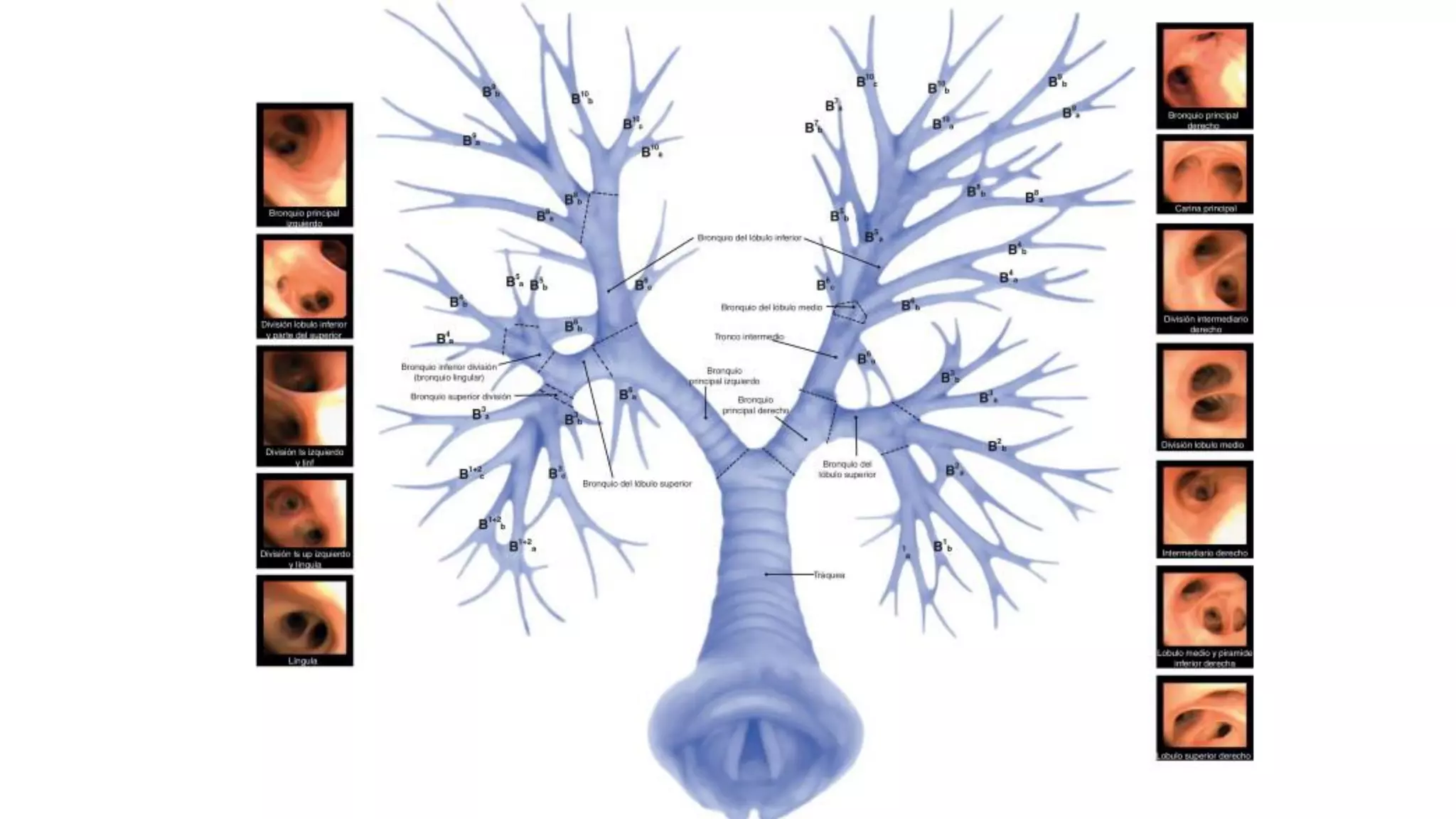 Árbol bronquial. Bronquios. Aparato respiratorio | PDF