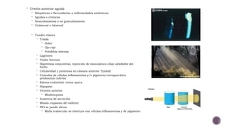 Clase 17 Uveítis para oftalmología .pptx