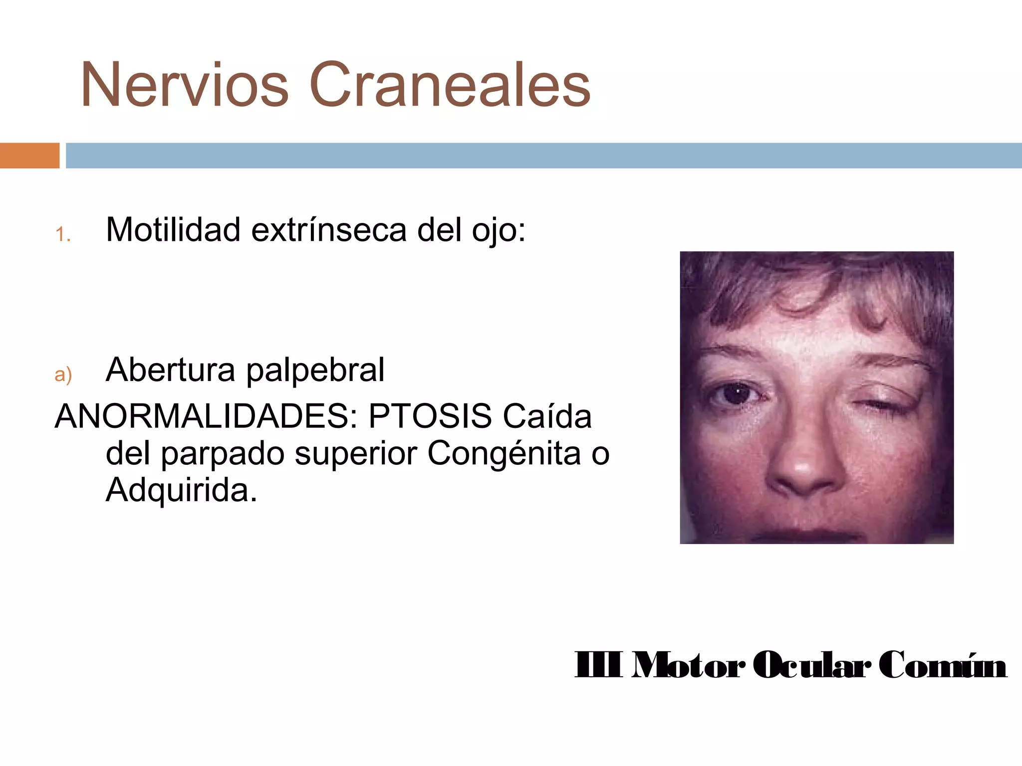Clase 18 evaluacion pares craneales nervio facial | PPT