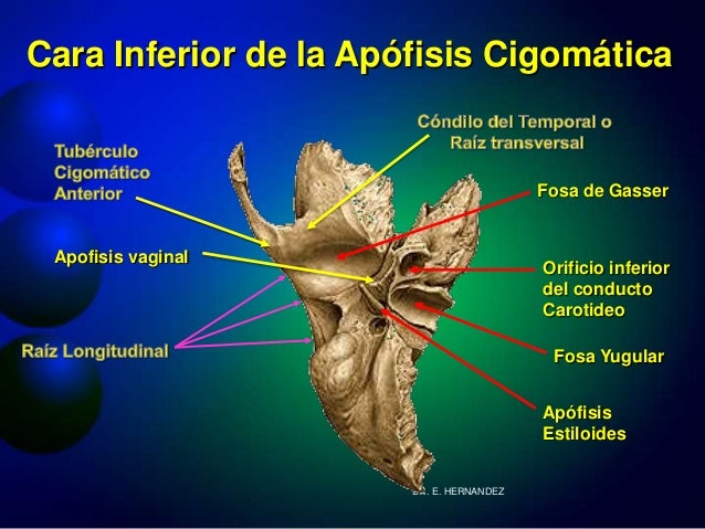 Cabeza osea adulto R.N. - neurocraneo