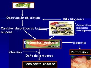 Clase 1 Cirugía II Colecistitis Aguda | PPTX