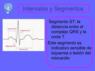 Clase 1 interpretación del electrocardiograma i | PPT