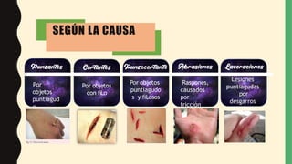 clasificación de las heridas, COMPLICACIONES EN LA CICATRIZACIÓN DE LAS ...