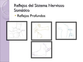 Clase 21 evaluacion reflejos superficiales y profundos | PPT