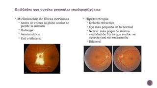 Clase 27 El nervio optico y sus patologias.pptx