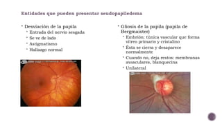 Clase 27 El nervio optico y sus patologias.pptx