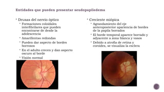 Clase 27 El nervio optico y sus patologias.pptx