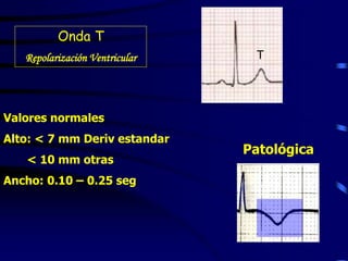 Clase 2 EKG.ppt