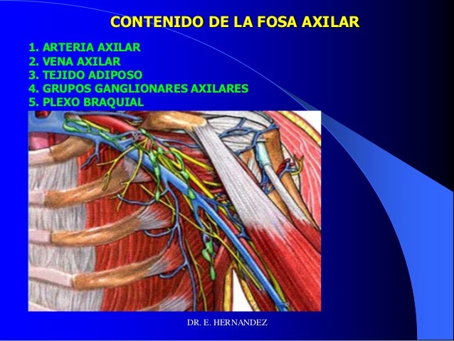 Linfonodomegalia Axilar Linfonodomegalia Axilar