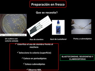 Clase2 Cultivos fungicos y respuesta inmunitaria frente a hongos ...