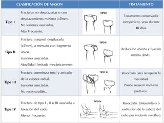 FRACTURA DEL OLÉCRANON, CÚPULA RADIAL, FRACTURA DIAFISIARIA CÚBITO ...