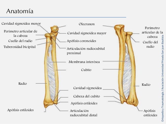 FRACTURA DEL OLÉCRANON, CÚPULA RADIAL, FRACTURA DIAFISIARIA CÚBITO, R…