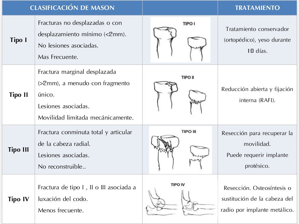 FRACTURA DEL OLÉCRANON, CÚPULA RADIAL, FRACTURA DIAFISIARIA CÚBITO, R…
