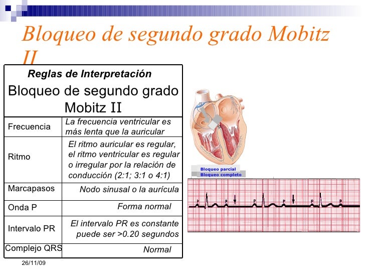 ECG-2