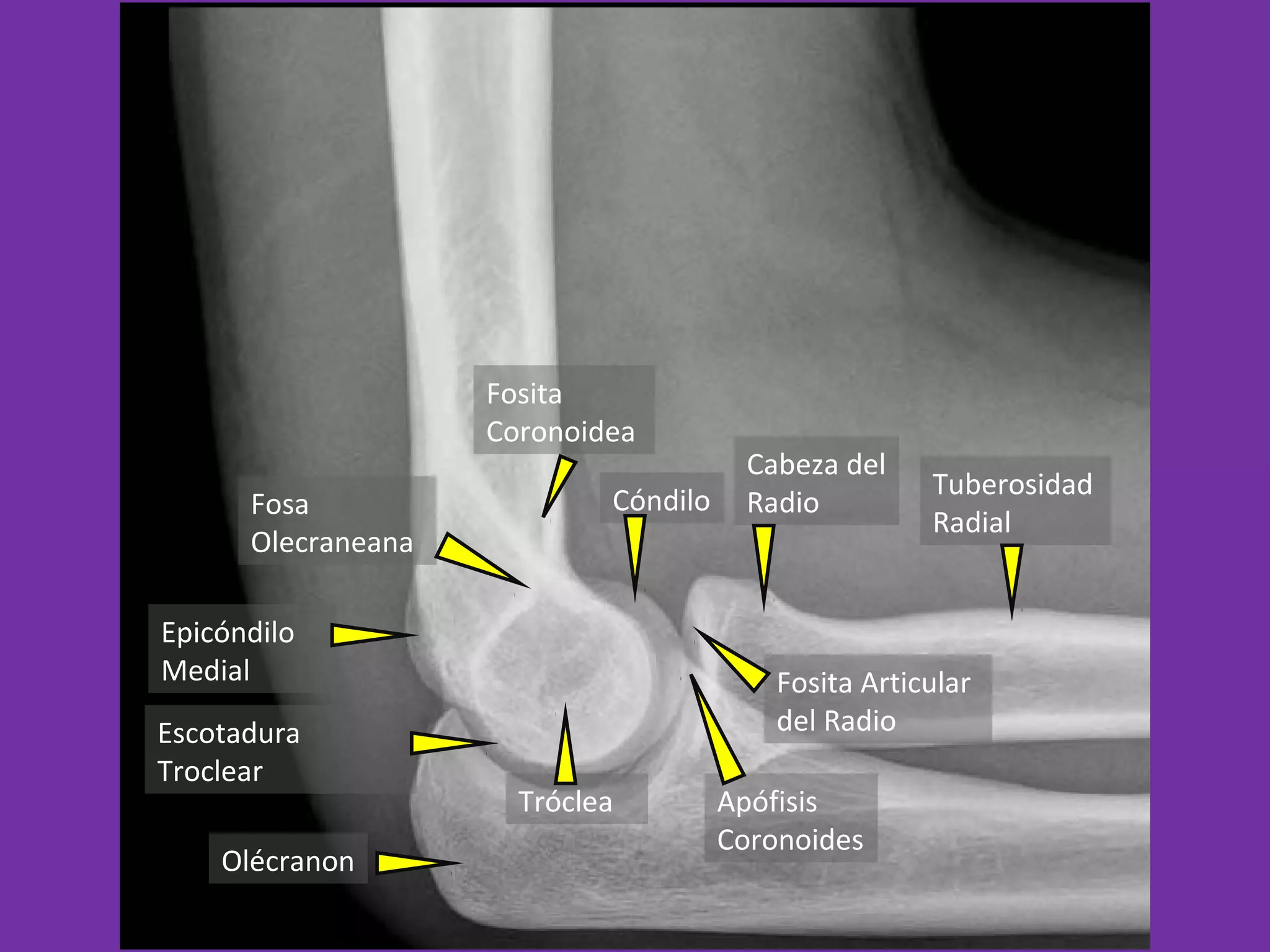 Clase 4 Brazo Codo Antebrazo Ppt