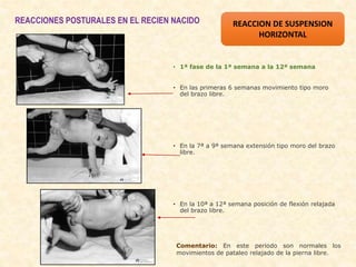 COMPONENTES NEUROFISIOLOGICOS EN EL EQUILIBRIO Y LA POSTURA | PPTX