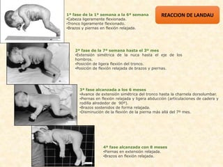 COMPONENTES NEUROFISIOLOGICOS EN EL EQUILIBRIO Y LA POSTURA | PPT