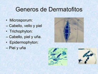 claseskskksskksn 4 Dermatofitos II tinea.ppt