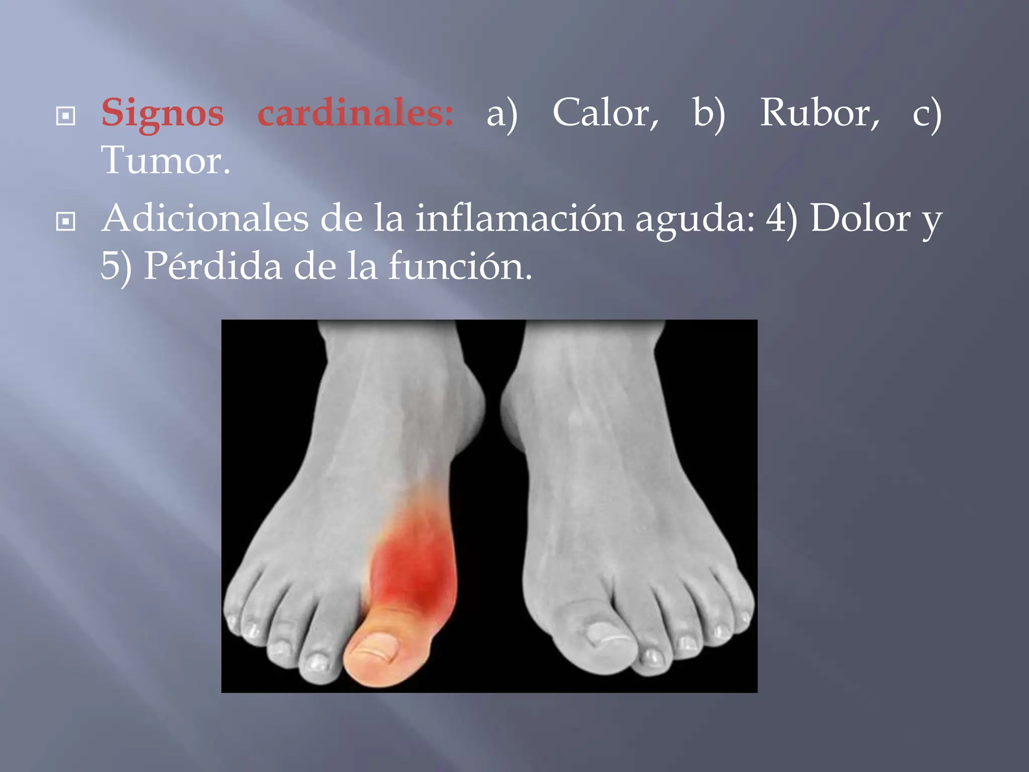 inflamacion Alteraciones funcionales a nivel de la Inflamación | PPT