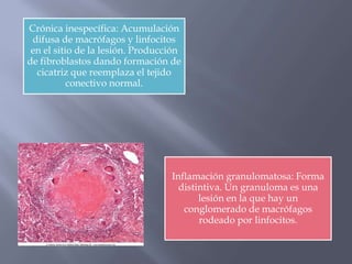 inflamacion Alteraciones funcionales a nivel de la Inflamación | PPTX