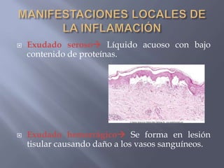 inflamacion Alteraciones funcionales a nivel de la Inflamación | PPTX