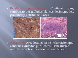 inflamacion Alteraciones funcionales a nivel de la Inflamación | PPTX