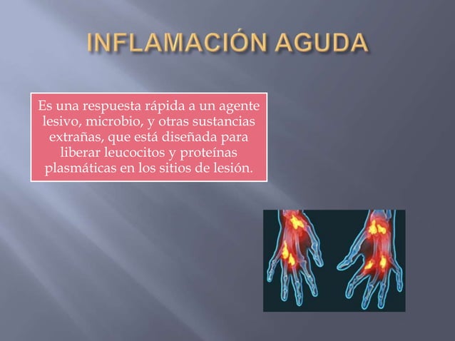 inflamacion Alteraciones funcionales a nivel de la Inflamación | PPT