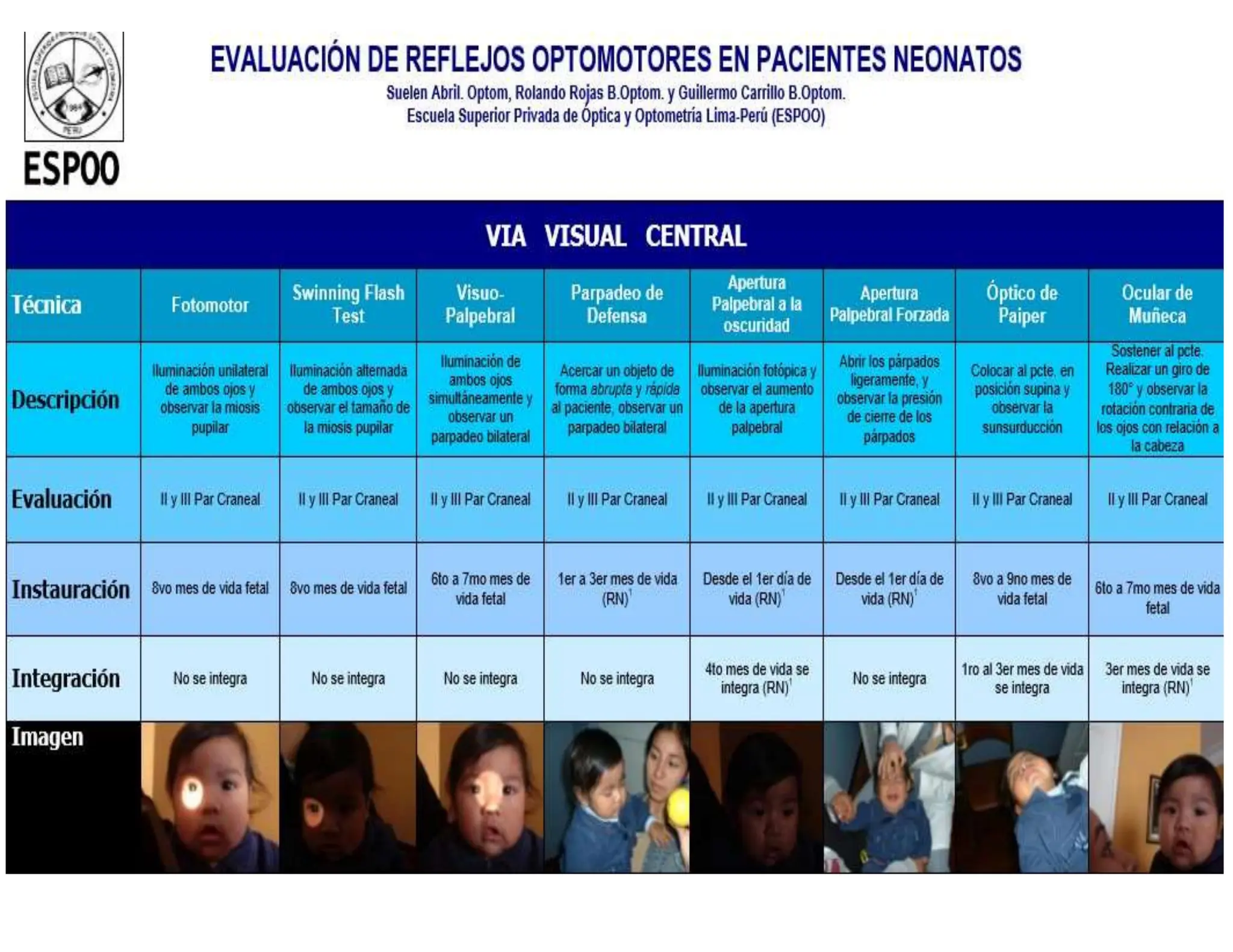 CLASE 4 REFLEJO fotomotores optometria 2024 | PPTX