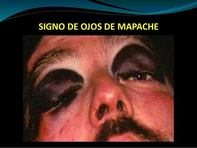 Clase 4 tac de cerebro y tec 2014