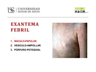 Clase 5. Exantema febril.pptx
