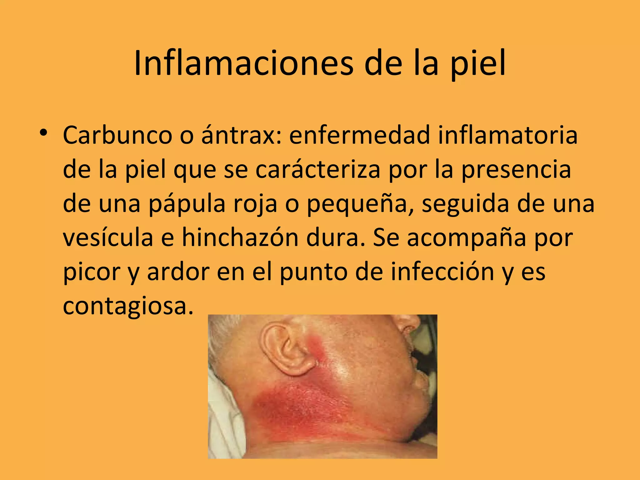 Clase #5 inflamaciones de la piel | PPT