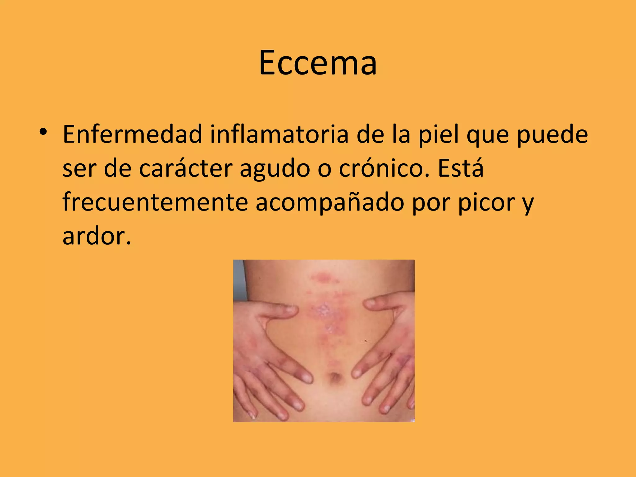Clase #5 inflamaciones de la piel | PPT