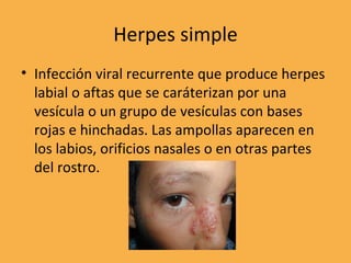 Clase #5 inflamaciones de la piel | PPT