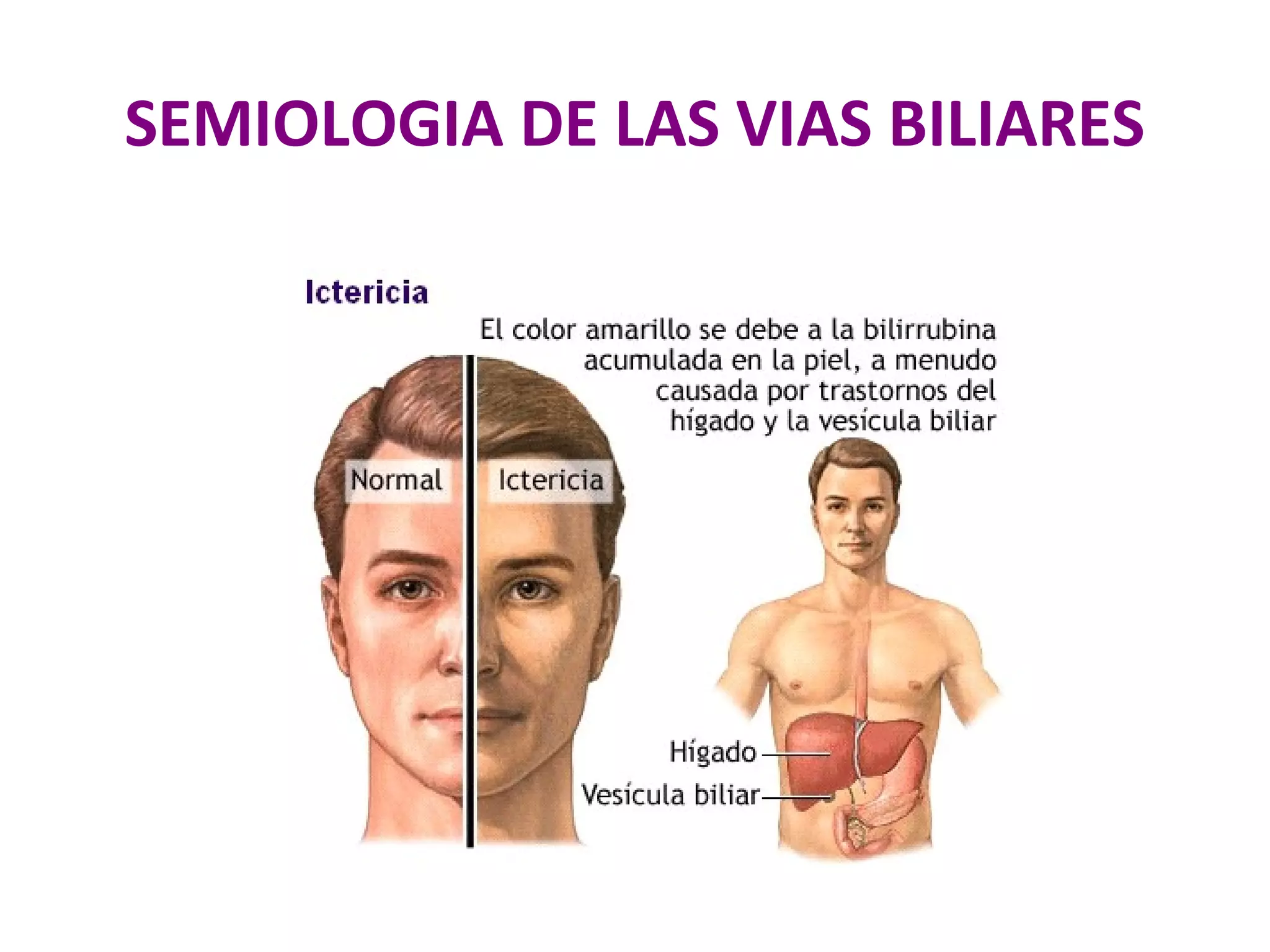 Clase 5 b semiologia de pancreas y vias biliares