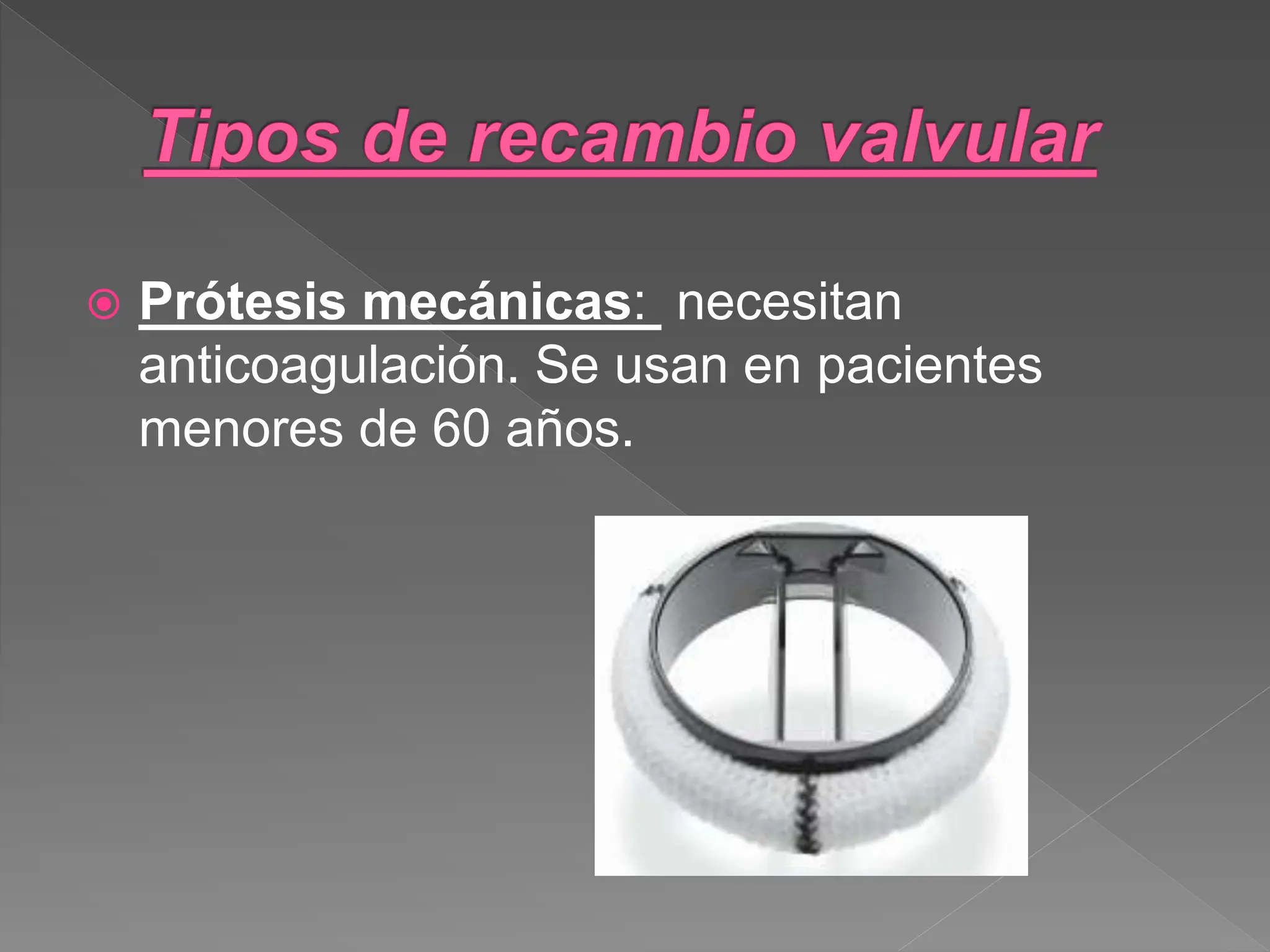 Clase 5 CCV UNAJ Reemplazo Valvula Aortica Y Mitral | PPT