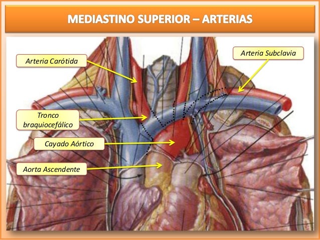 Clase 5 mediastino