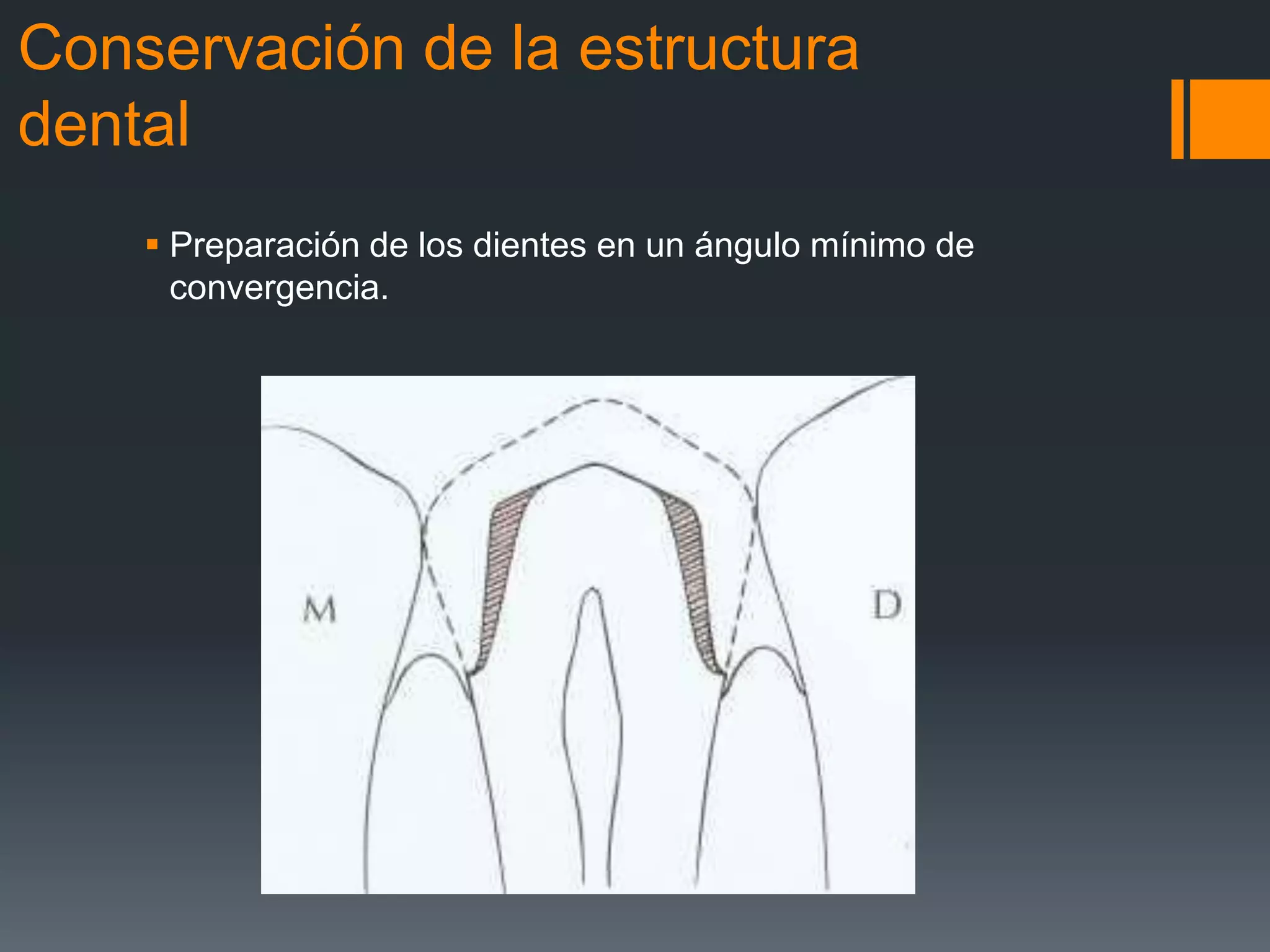 Principios para el tallado de dientes en prótesis | PPTX | Oral care ...