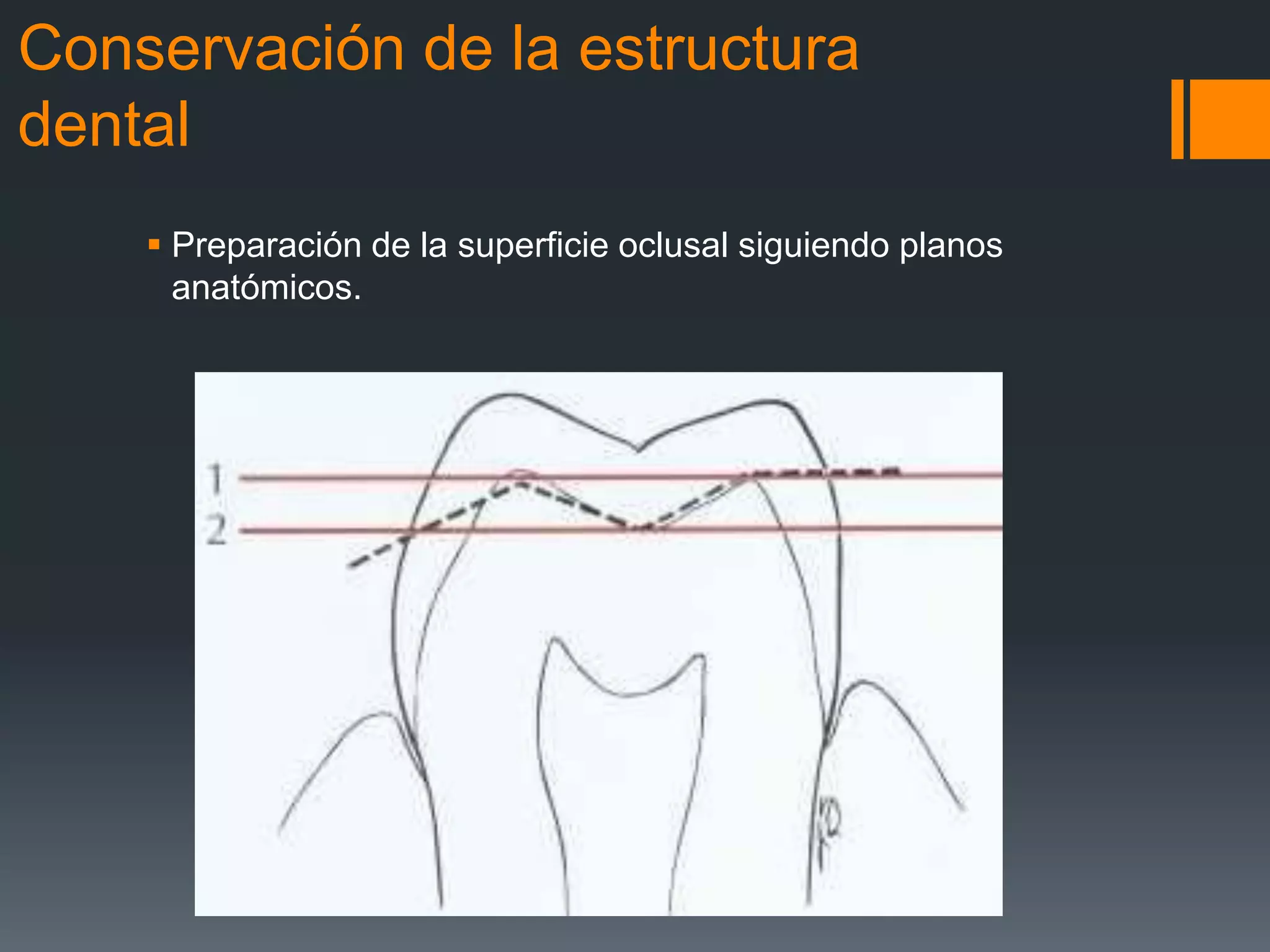 Principios para el tallado de dientes en prótesis | PPTX | Oral care ...