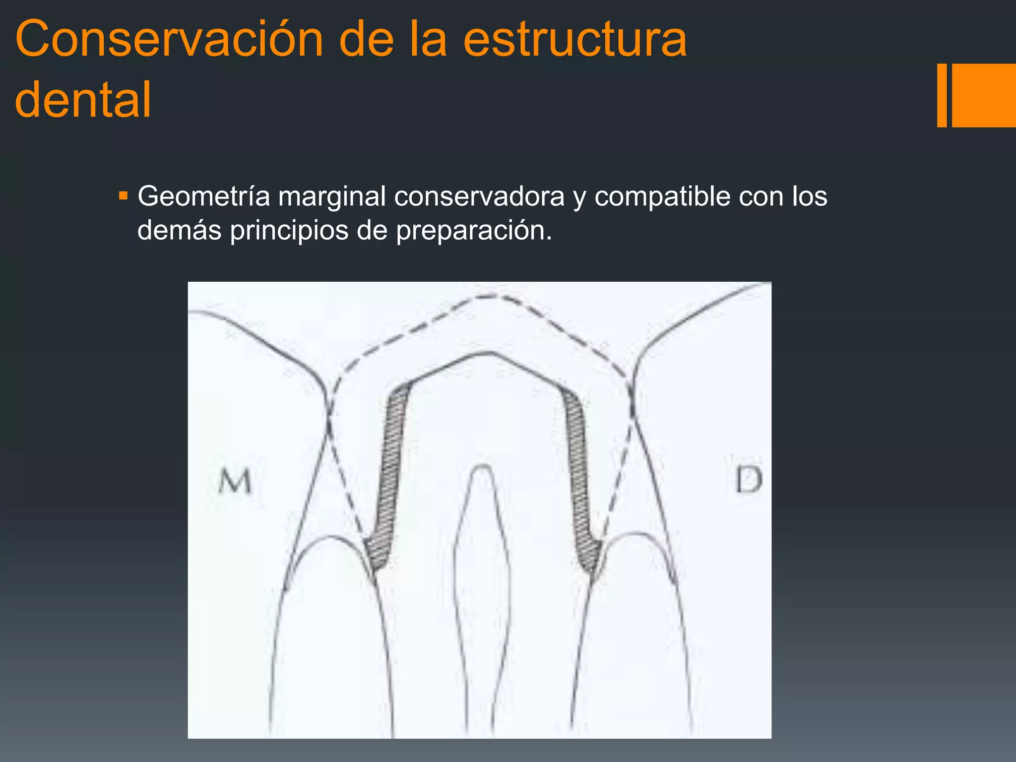 Principios para el tallado de dientes en prótesis | PPTX | Oral care ...