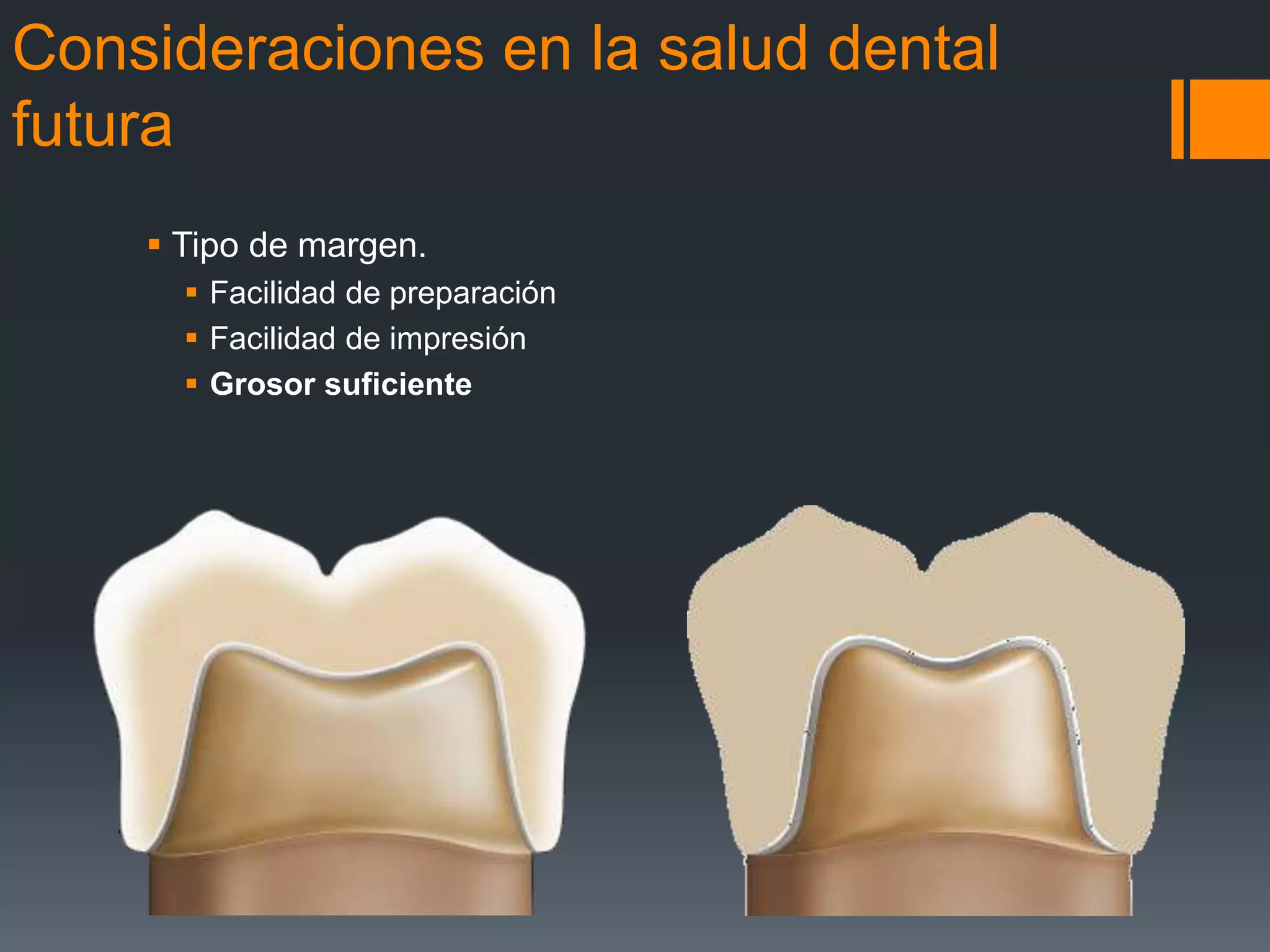 Principios para el tallado de dientes en prótesis | PPTX | Oral care ...