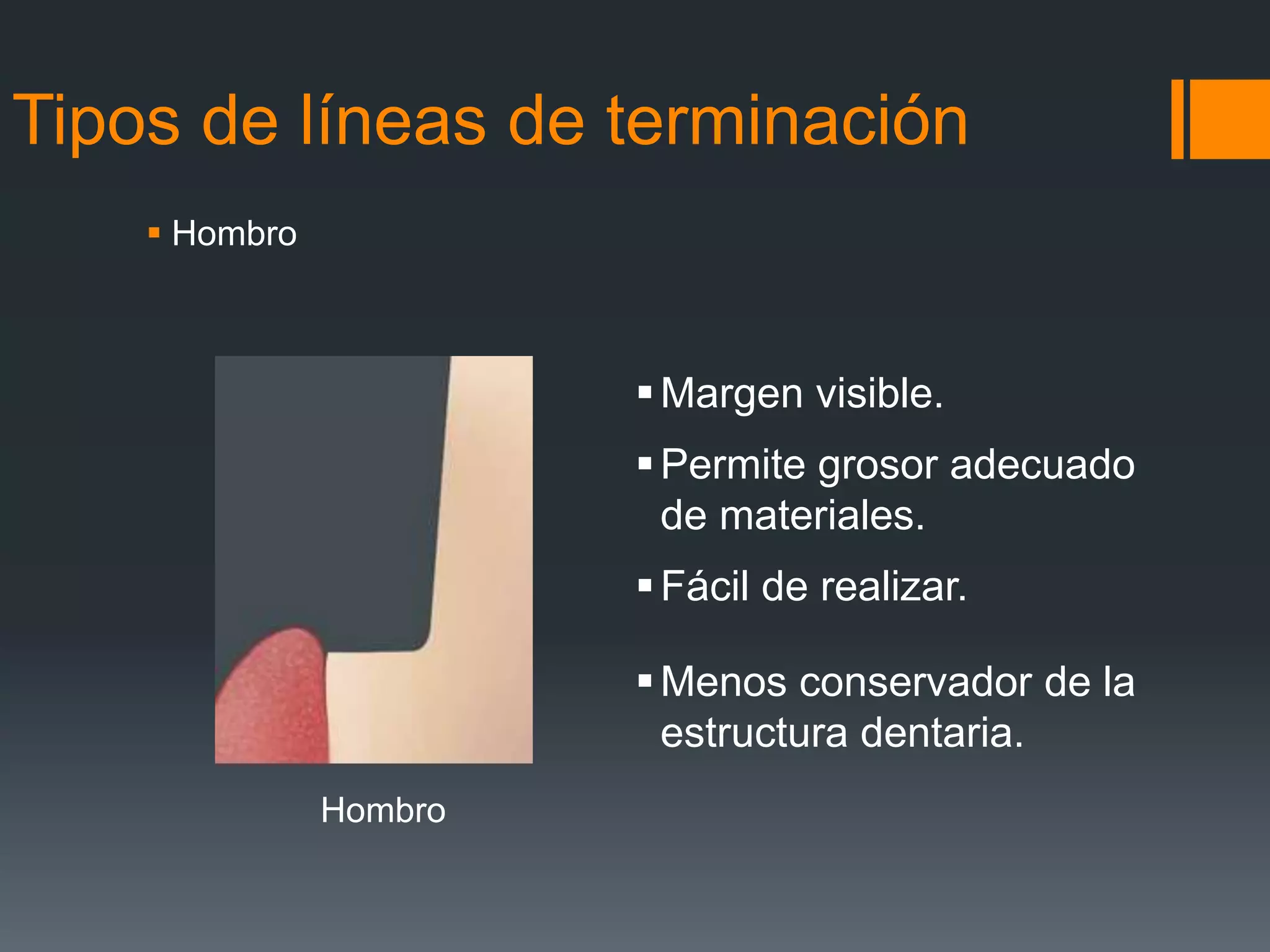 Principios para el tallado de dientes en prótesis | PPTX | Oral care ...
