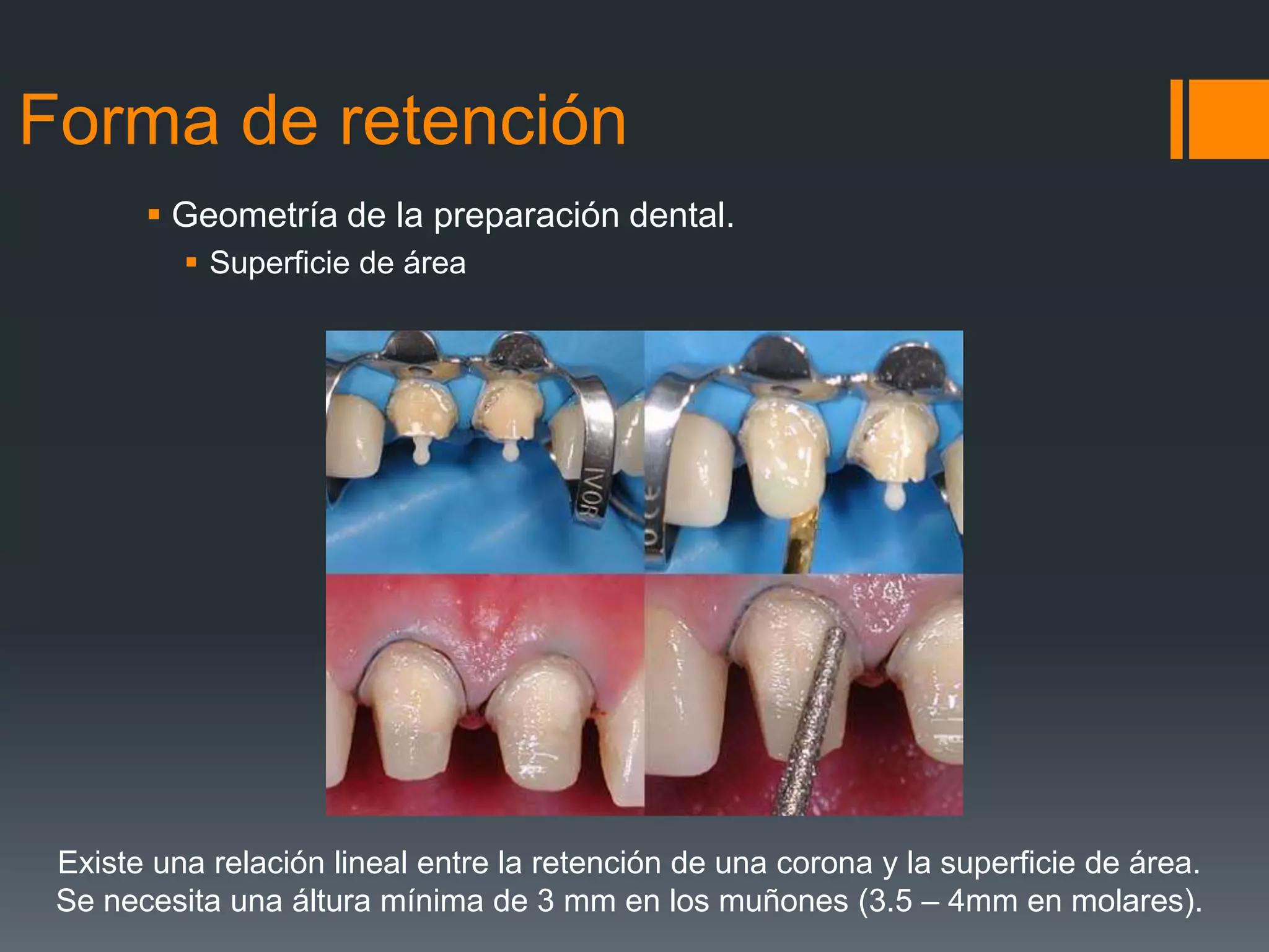 Principios para el tallado de dientes en prótesis | PPTX | Oral care ...