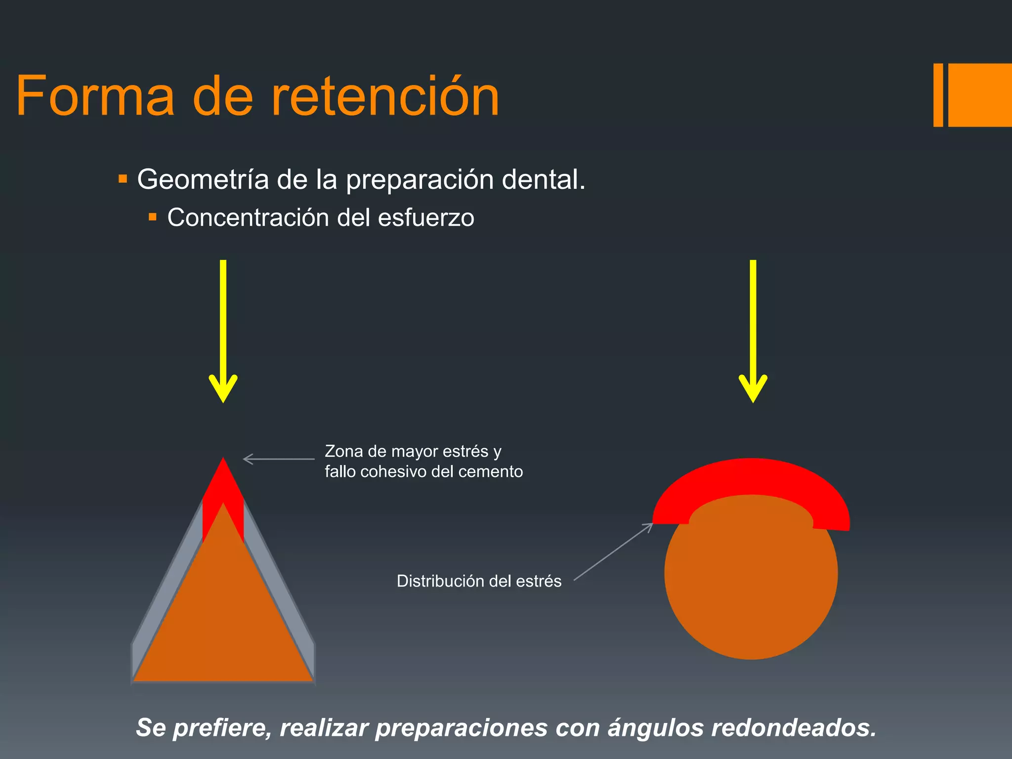 Principios para el tallado de dientes en prótesis | PPTX | Oral care ...