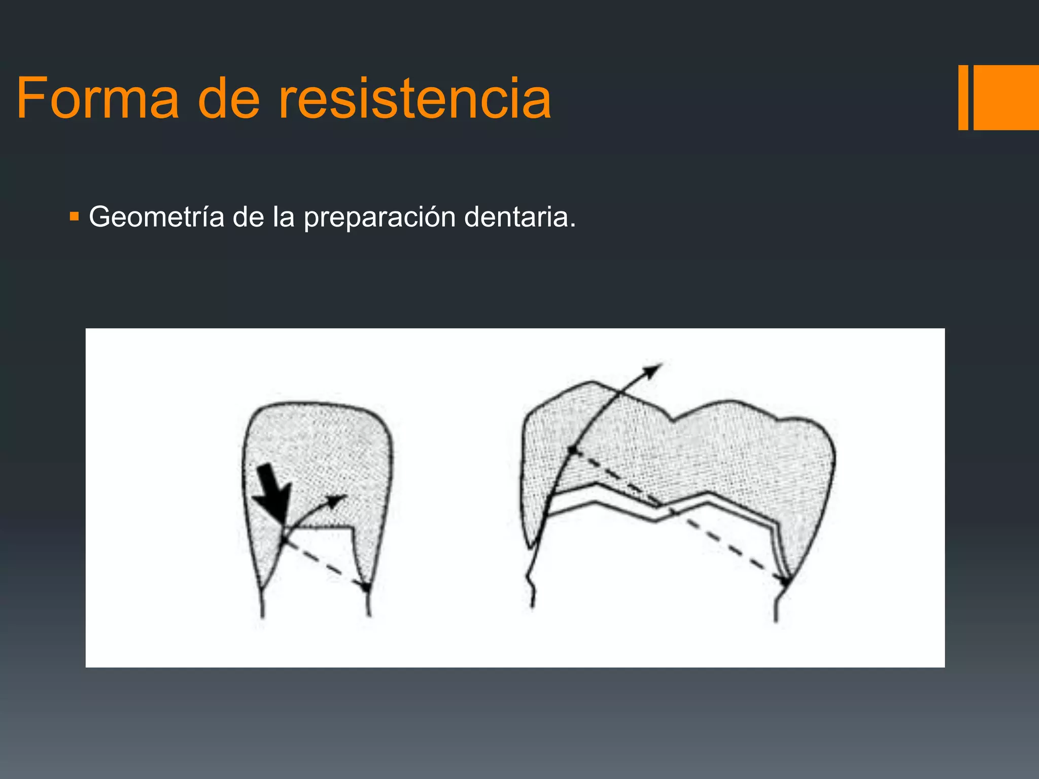 Principios para el tallado de dientes en prótesis | PPTX | Oral care ...